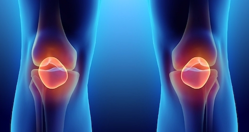 Menisküs Yırtığı - Ortopedi ve Travmatoloji Uzmanı